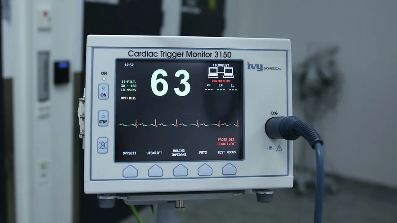 9 Cara Membaca EKG untuk Pemeriksaan Jantung, Pahami Tahapannya - Hot ...