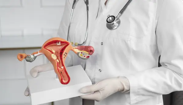 Mengenal Merariq, Tradisi 'Kawin Lari' Suku Sasak - Regional Liputan6.com