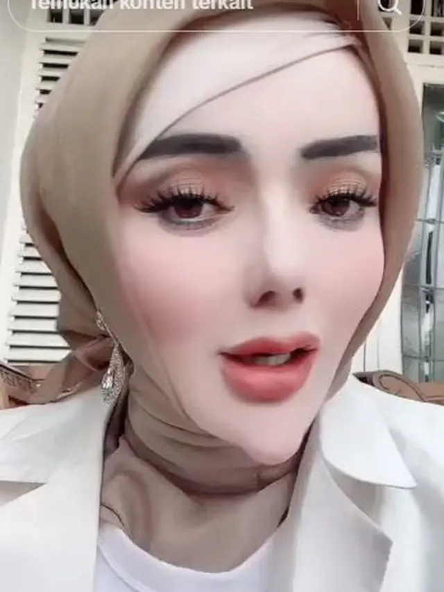 6 Potret Terkini Yuni Jasmine, PNS Lampung yang Viral Karena Dagunya ...