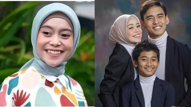 Potret 6 Artis Sebelum dan Sesudah Hilangkan Gigi Gingsul, Tuai ...