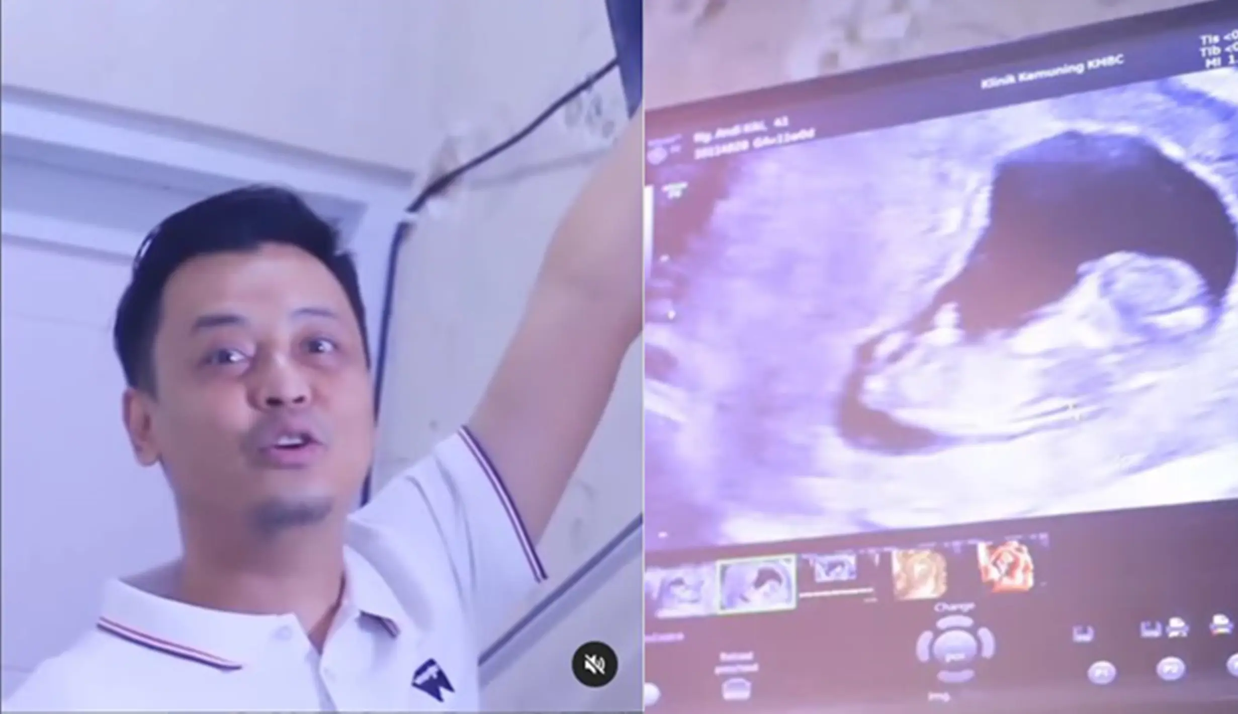 Potret Kiki Amalia Umumkan Kehamilan Pertama di Usia 41 Tahun, Penuh Bahagia - Foto Liputan6.com