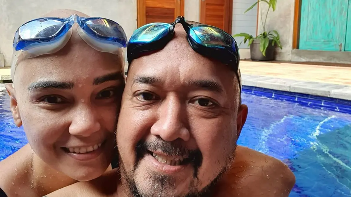 Feby Febiola Tampil Plontos, Suami Ikut Gunduli Rambutnya - Photo ...