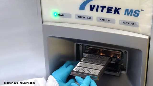 Vitek MS, Hanya Dua Detik Identifikasi Bakteri dalam Darah - Health ...