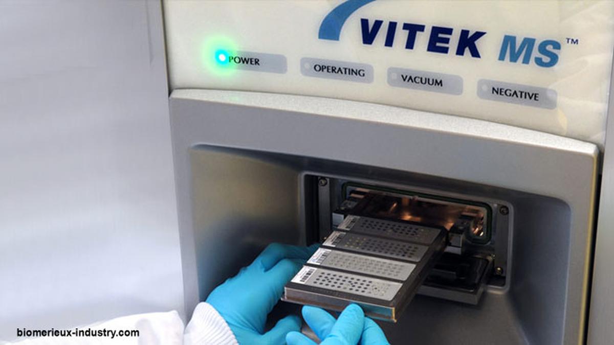 Vitek MS, Hanya Dua Detik Identifikasi Bakteri dalam Darah - Health ...