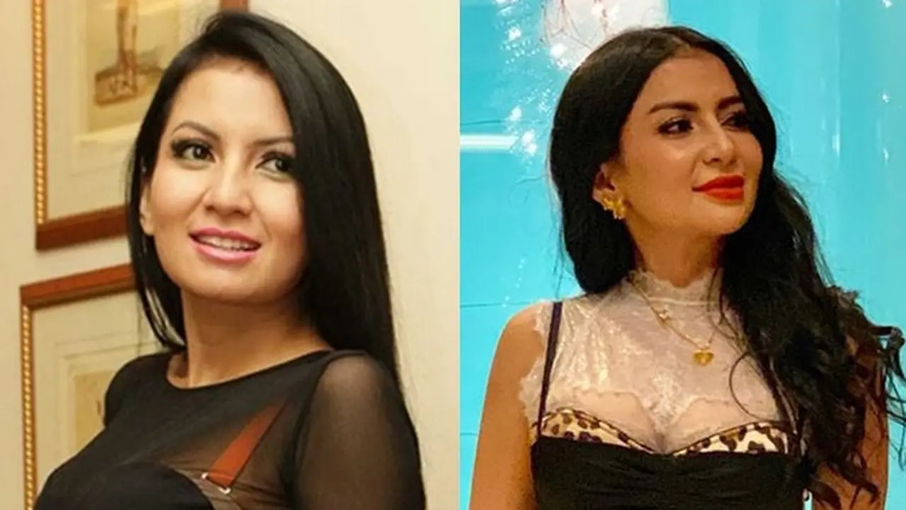 6 Artis Tanah Air Ini Pernah Suntik Filler Bibir, Terbaru Lucinta Luna ...