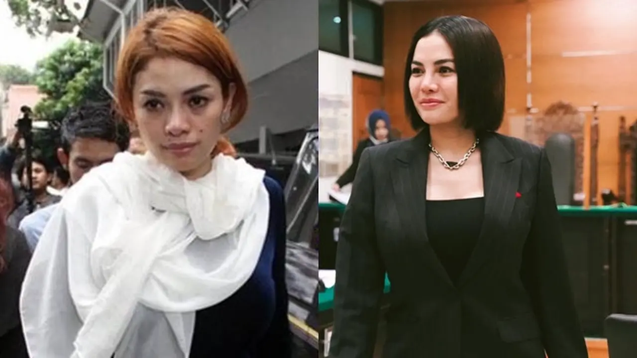 Beda Penampilan 9 Artis Sebelum vs Setelah Operasi Plastik, Bikin ...