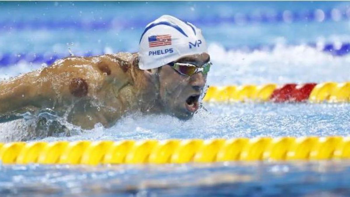 Tingkatkan Performa, Para Atlet Olimpiade Jalani Terapi Kop - Health ...