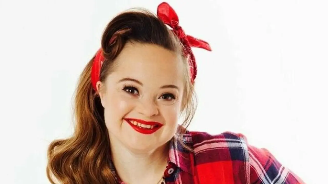Katie Meade, Difabel Down Sydrome yang Jadi Model Produk Kecantikan ...