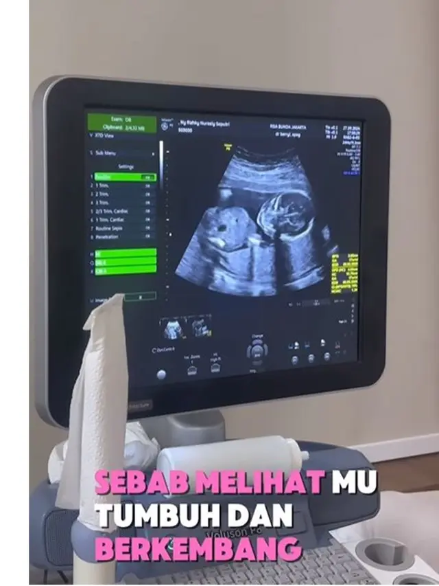 6 Potret Kiky Saputri Umumkan Hamil Usai Keguguran, Banjir Doa - Hot Liputan6.com