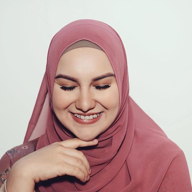 6 Potret Terbaru Irish Bella Tampil Pakai Behel, Ingin Hilangkan ...