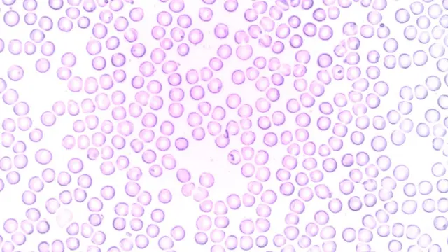 5 Jenis Leukosit, Ciri-Ciri dan Fungsinya Masing-Masing - Hot Liputan6.com