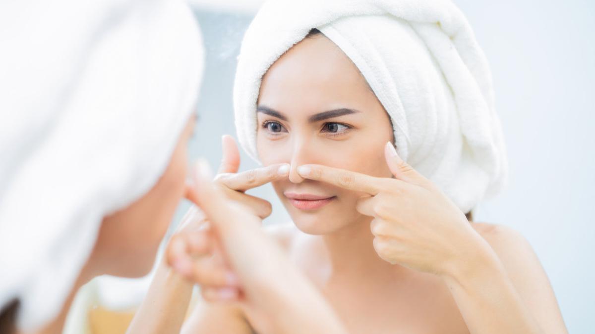 Komedo Hitam Menumpuk di Hidung, Basmi Segera dengan 10 Tips Mudah Ini ...