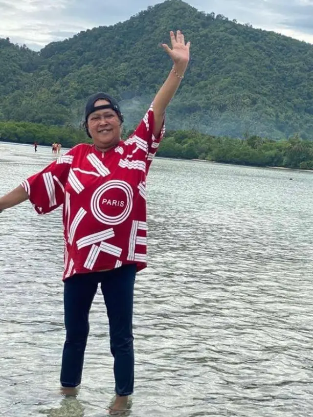 6 Fakta Kaki Suti Karno Diamputasi Karena Diabetes, Berawal Dari ...