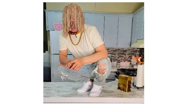 Rapper Ini Pasang Implan Rantai Emas Sebagai Pengganti Rambut, Curi ...