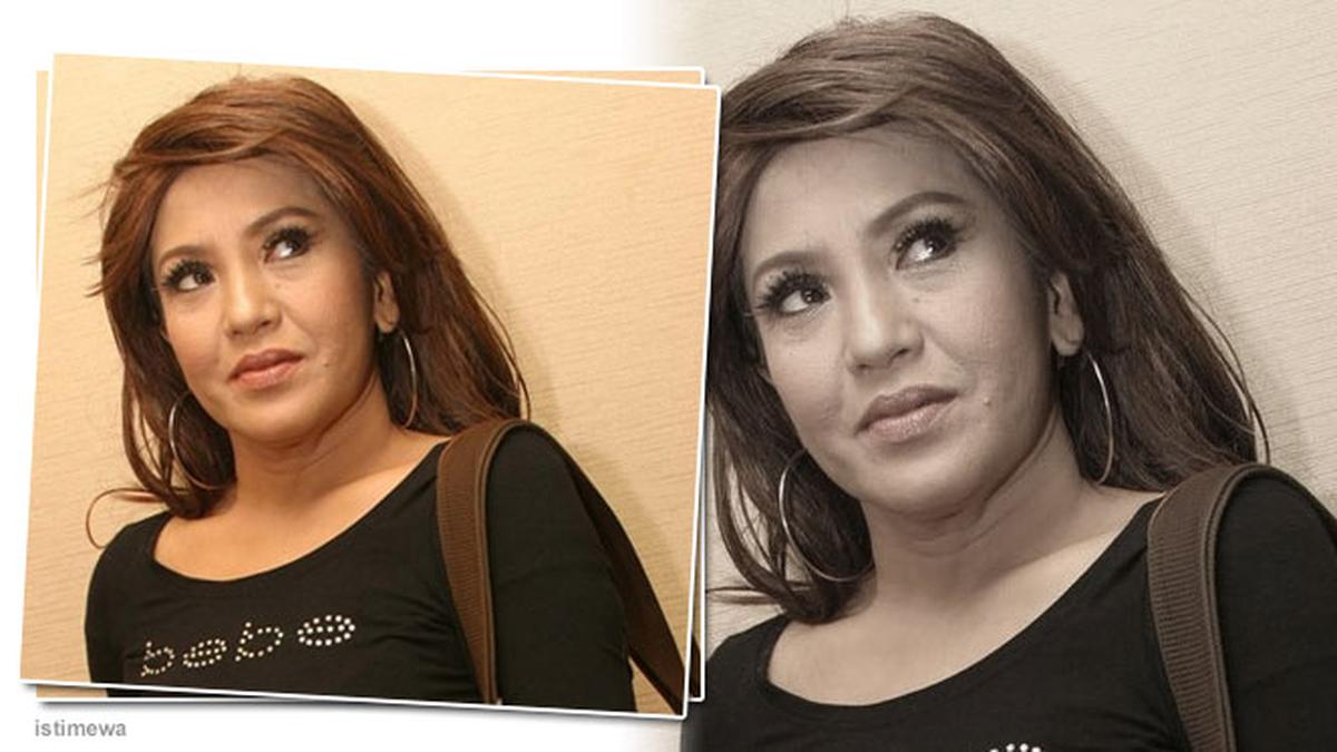 Sempat Koma, Ully Artha Meninggal Dunia