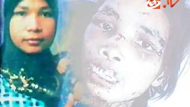 Sumiati Mulai Membaik - News Liputan6.com