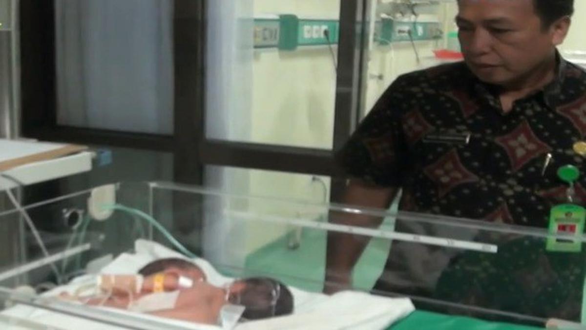 Bayi Kembar Siam Dempet Tunggu Waktu Operasi di Buleleng - News ...
