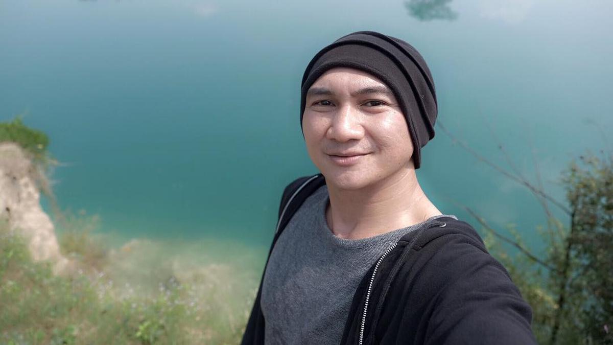 Bengkak, Telinga Anak Anji Segera Dioperasi?