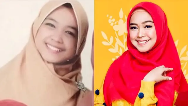 Ria Ricis Pamit dari YouTube, Ini 7 Potret Transformasinya hingga ...