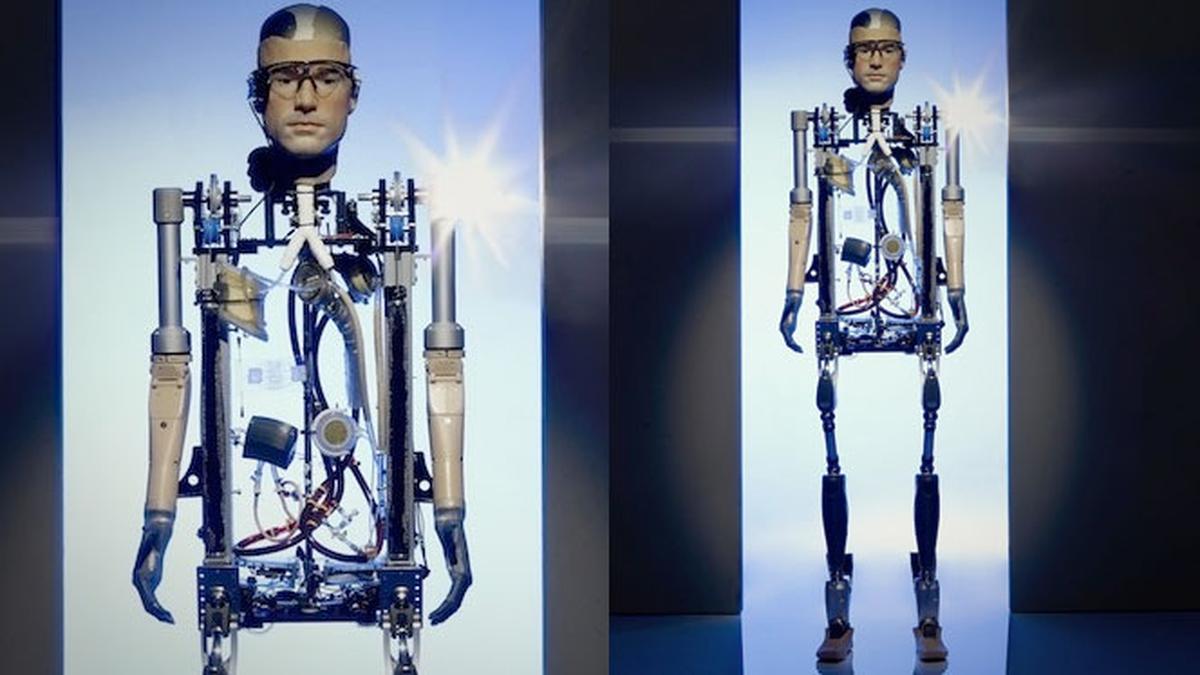 Perkenalkan, Manusia Bionik Utuh `Frankenstein` Pertama di Dunia ...
