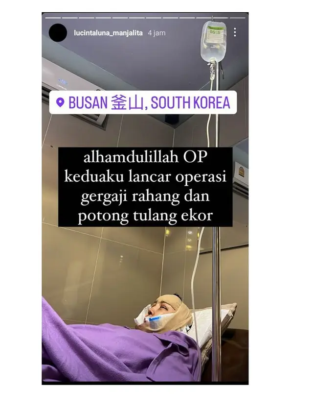 8 Potret Lucinta Luna Operasi Plastik Lagi, Gergaji Rahang dan Potong ...