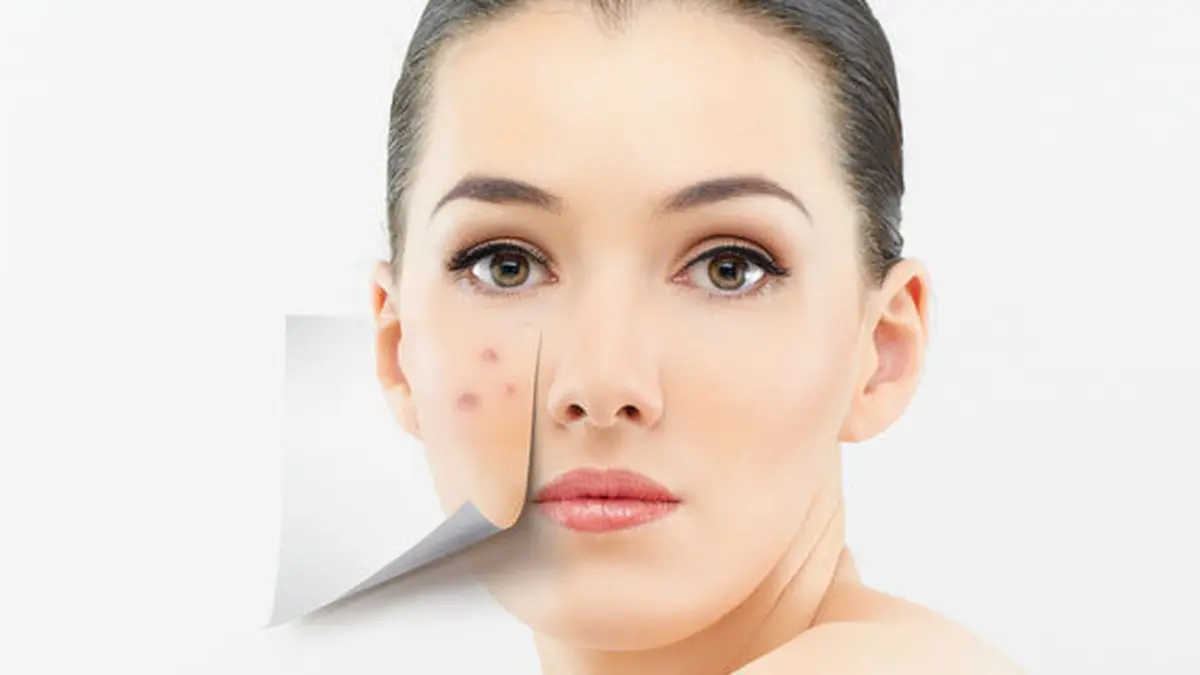 Ciri Kanker Kulit Sel Merkel (Bagian 2) - Beauty Fimela.com