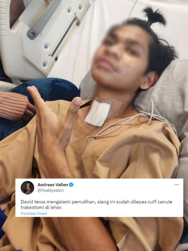 David Ozora Lepas Selang Kanul Trakeostomi di Leher Saat AG Pacar Mario ...