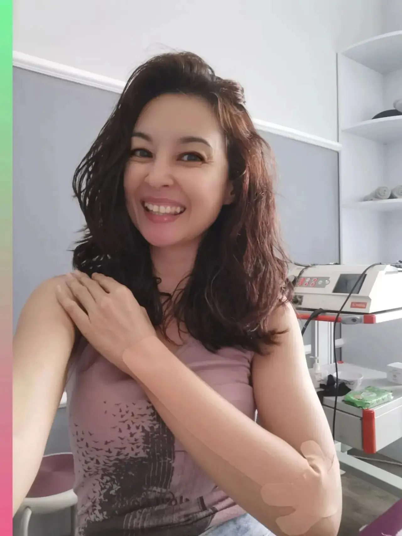 Putri Patricia Jalani Operasi Pengangkatan Tumor Pilih Terlebih Dulu Selesaikan Promo Film
