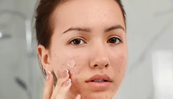 Apa Penyebab Meriang? Kenali Gejala dan Cara Mengatasinya - Feeds ...