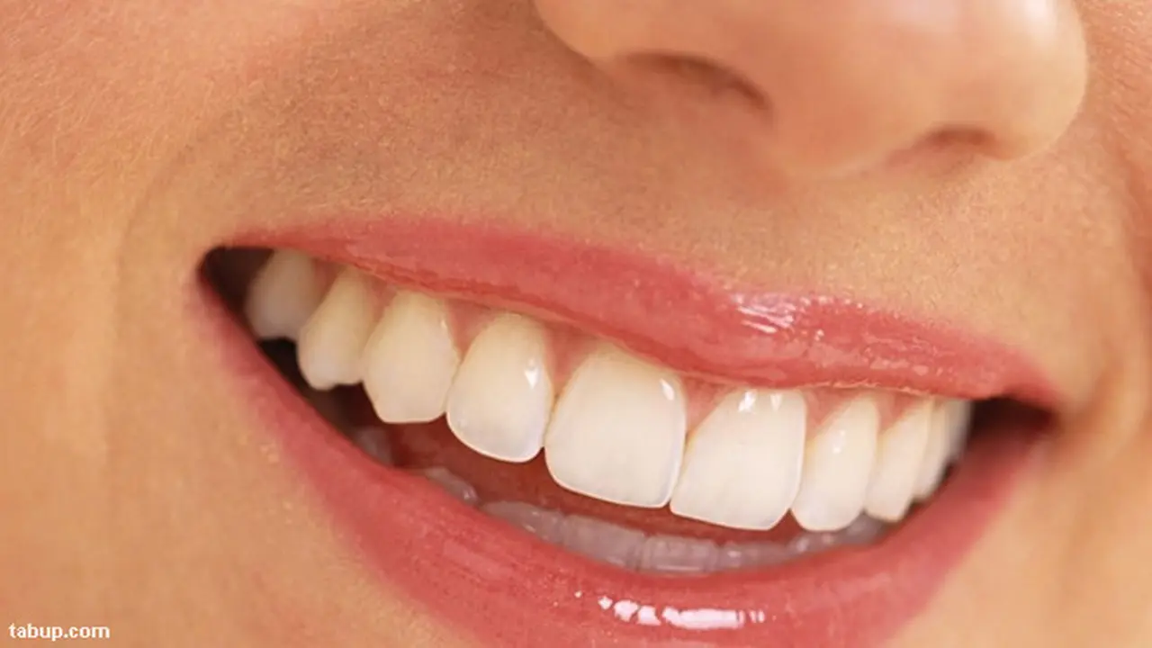 5 Penyakit Akibat Mulut dan Gigi yang Kotor - Health Liputan6.com