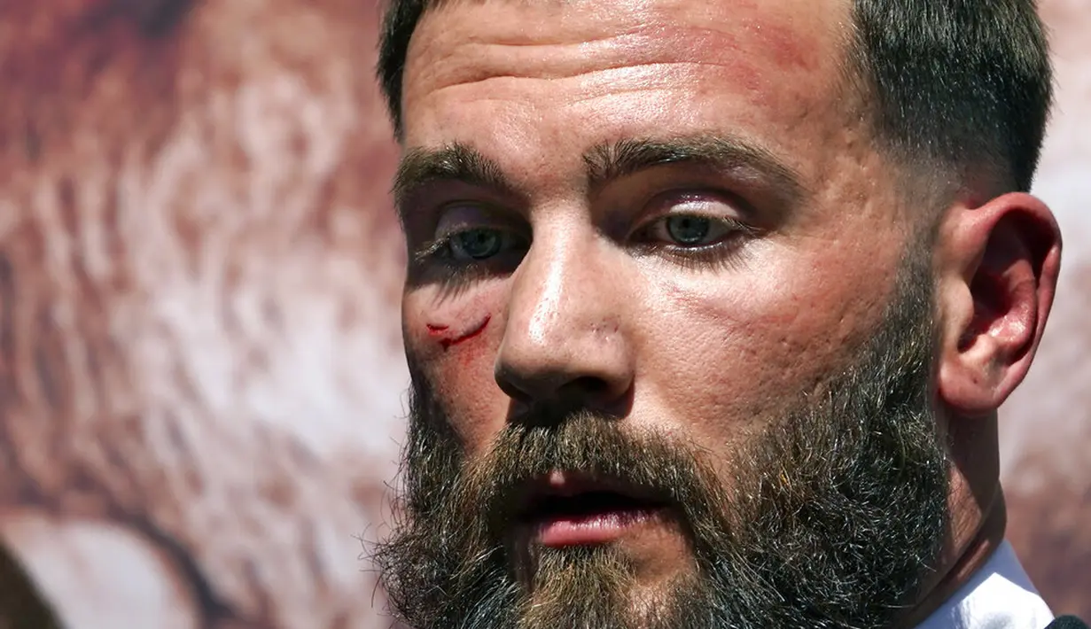 FOTO: Perkelahian Canelo Alvarez dan Caleb Plant Saat Konferensi Pers ...