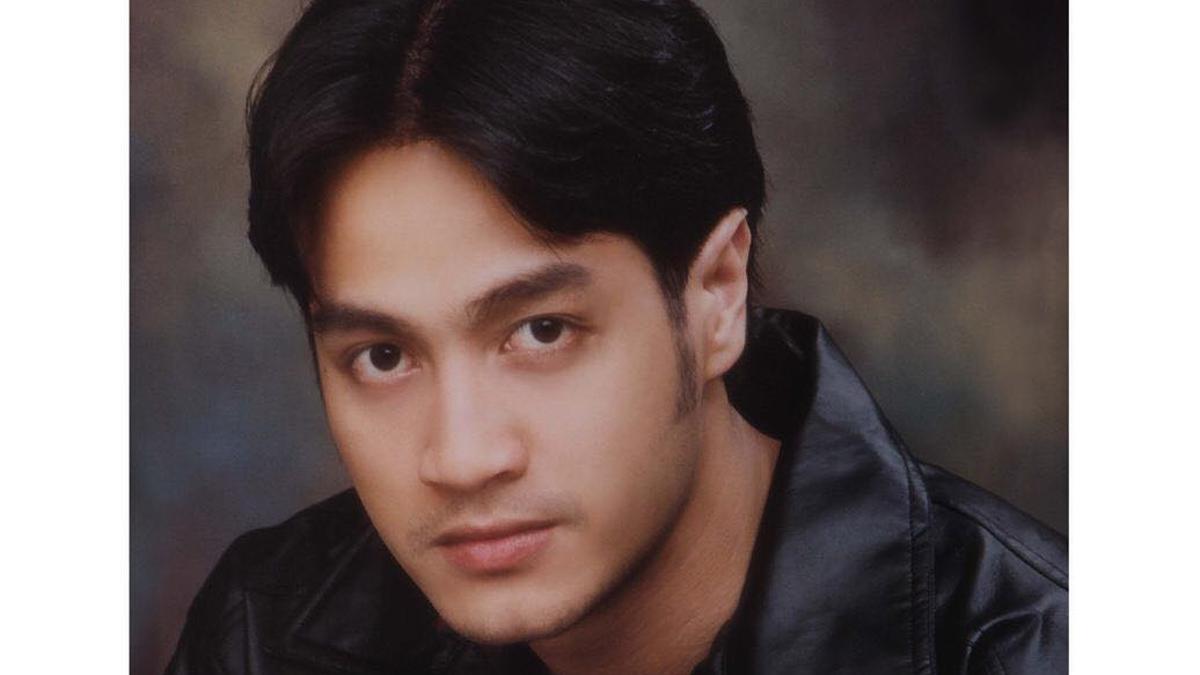 Aktor Ferry Irawan Dilarikan ke Rumah Sakit, Pembuluh Darah Saraf ...