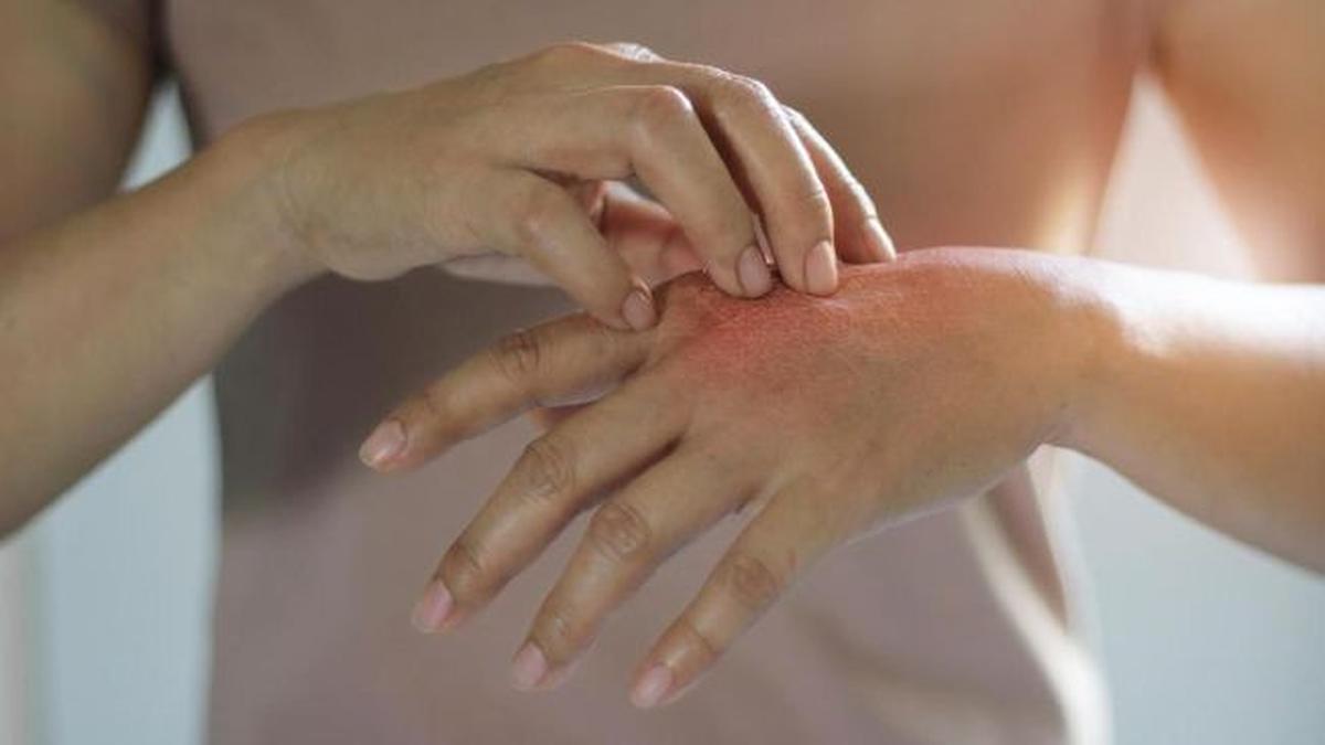 Coba 5 Bahan Ini untuk Atasi Kulit Tangan Kering Agar Kembali Lembab