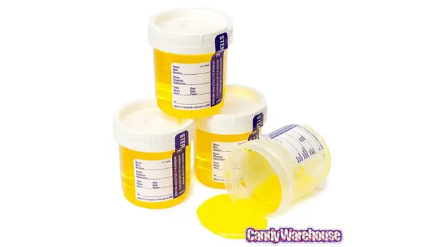 Upil Gorila Hingga Sup Permen, Ini 7 Camilan Paling Aneh di Dunia ...