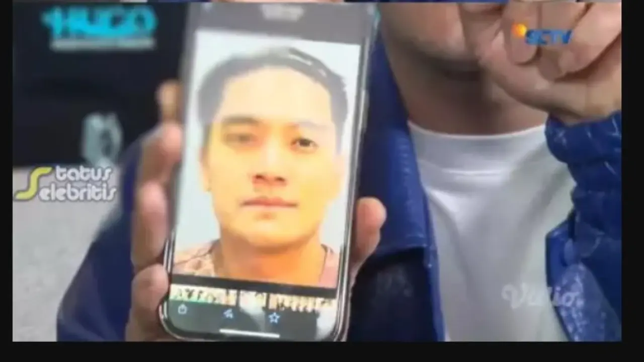 Boy William Ungkap Alasan Jalani Operasi Plastik untuk Ubah Bentuk ...