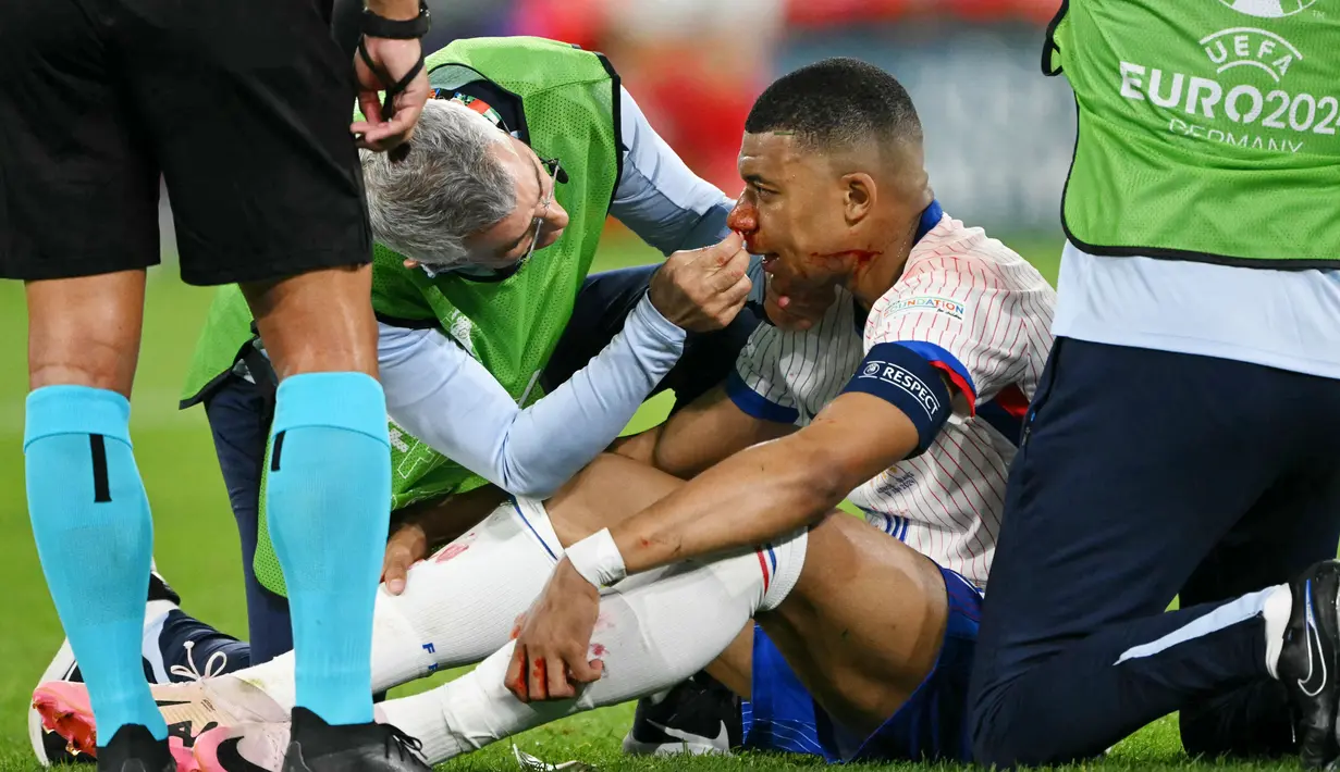 Foto: Momen Benturan Keras Kylian Mbappe dengan Pemain Austria, Berdarah-darah Hingga Tulang ...