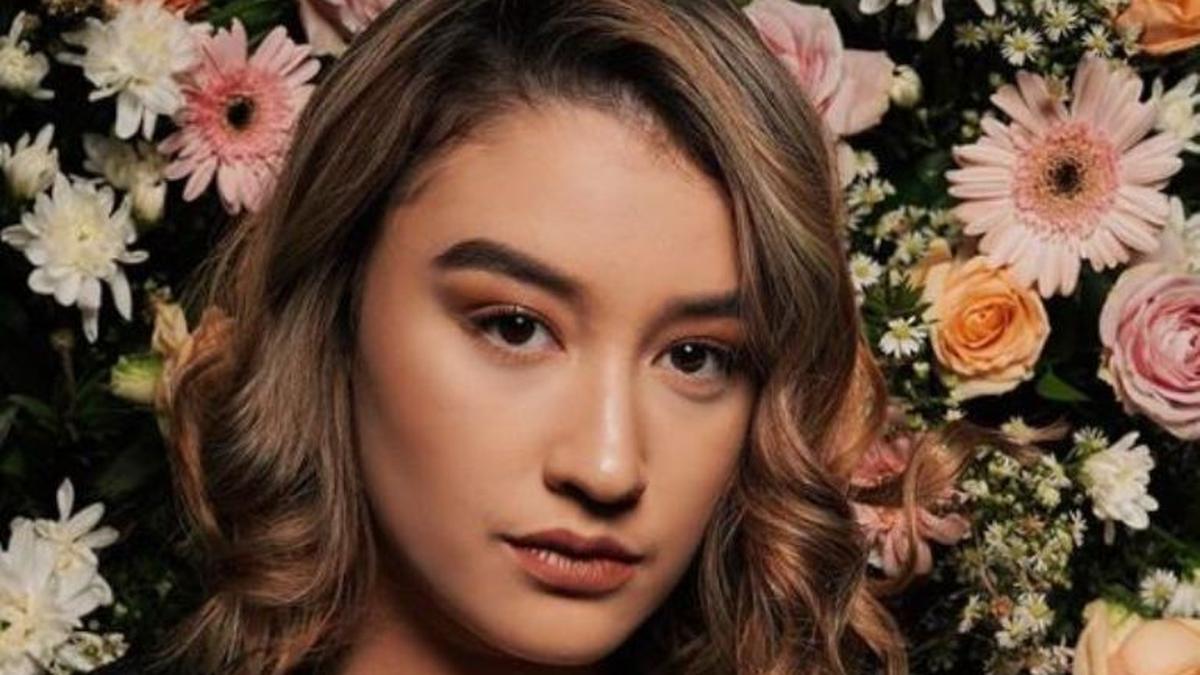 Suka Jam Hadiah Orangtua, Natasha Ryder Pakai Sampai Tangan Belang ...