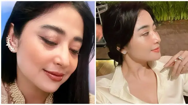 6 Potret Beda Penampilan Dewi Perssik Sebelum vs Setelah Operasi ...