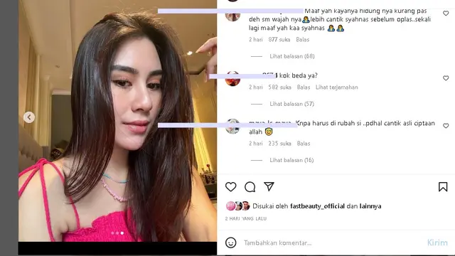 5 Potret Syahnaz Sadiqah Terbaru, Netizen Sebut Bagian Hidung dan ...