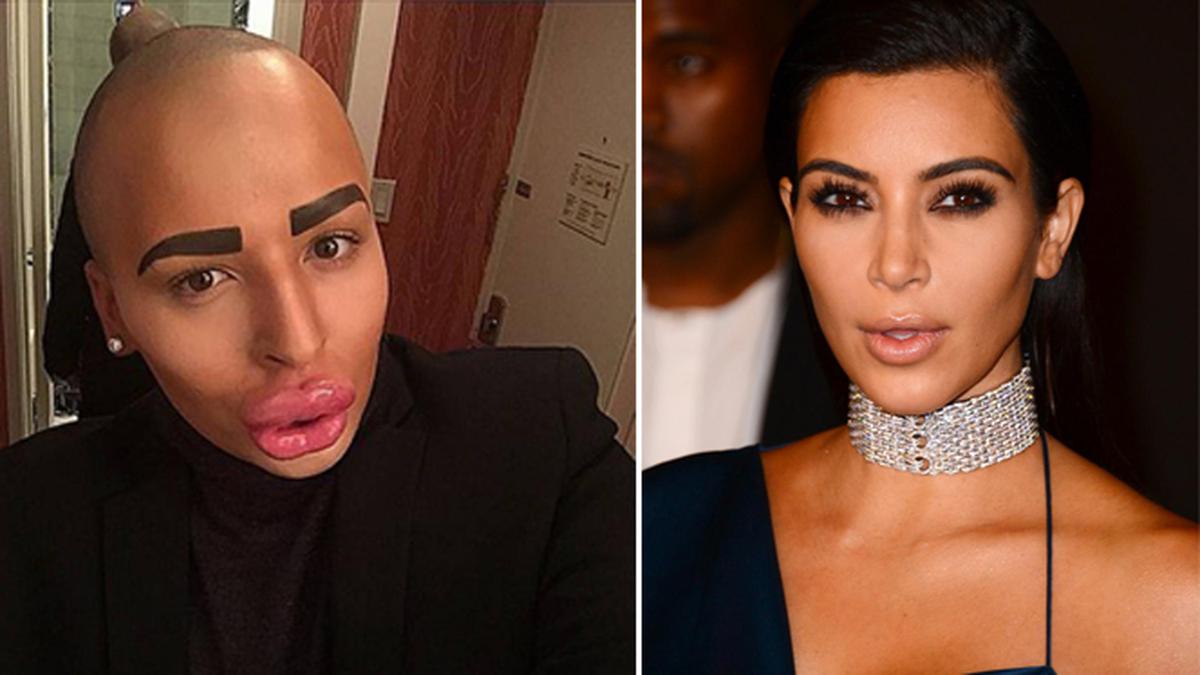 Begini Hasil Operasi Plastik Pria yang Kagumi Kim Kardashian - Fashion ...
