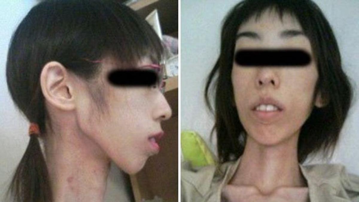 Disiksa Kakeknya Selama 10 Tahun, Kondisi Wanita Ini Memprihatinkan ...