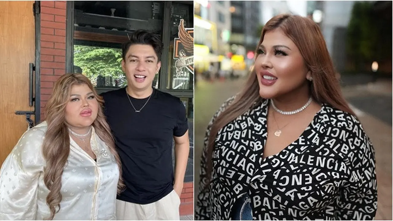 6 Potret Shindy Samuel Usai Operasi Bariatrik, Berat Badan Turun 34 Kg - Hot Liputan6.com