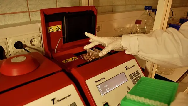 PCR adalah Singkatan dari Polymerase Chain Reaction, Kenali Cara ...