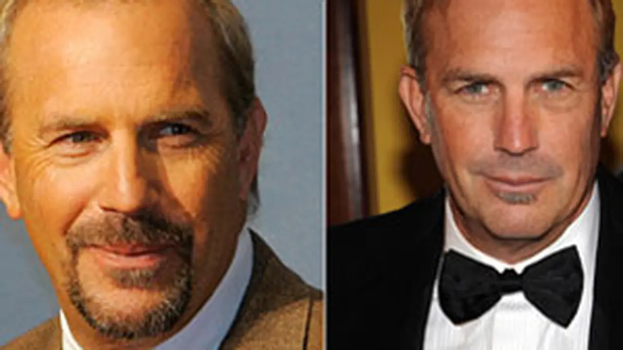 5 Selebriti Tampan yang Punya Masalah Kebotakan - Health Liputan6.com