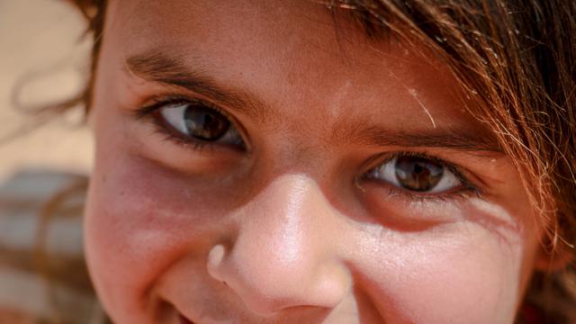 Apa itu Apple Cheeks? Berikut Penjelasannya - Beauty Fimela.com