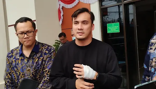 Profil Aria Baron Eks Gitaris GIGI yang Meninggal Dunia Setelah ...