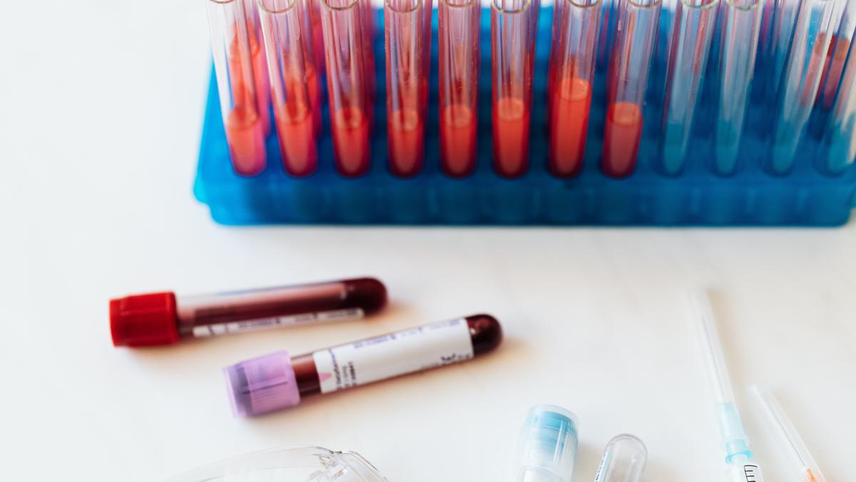 D-dimer adalah Pemeriksaan untuk Mendeteksi Masalah Pembekuan Darah ...