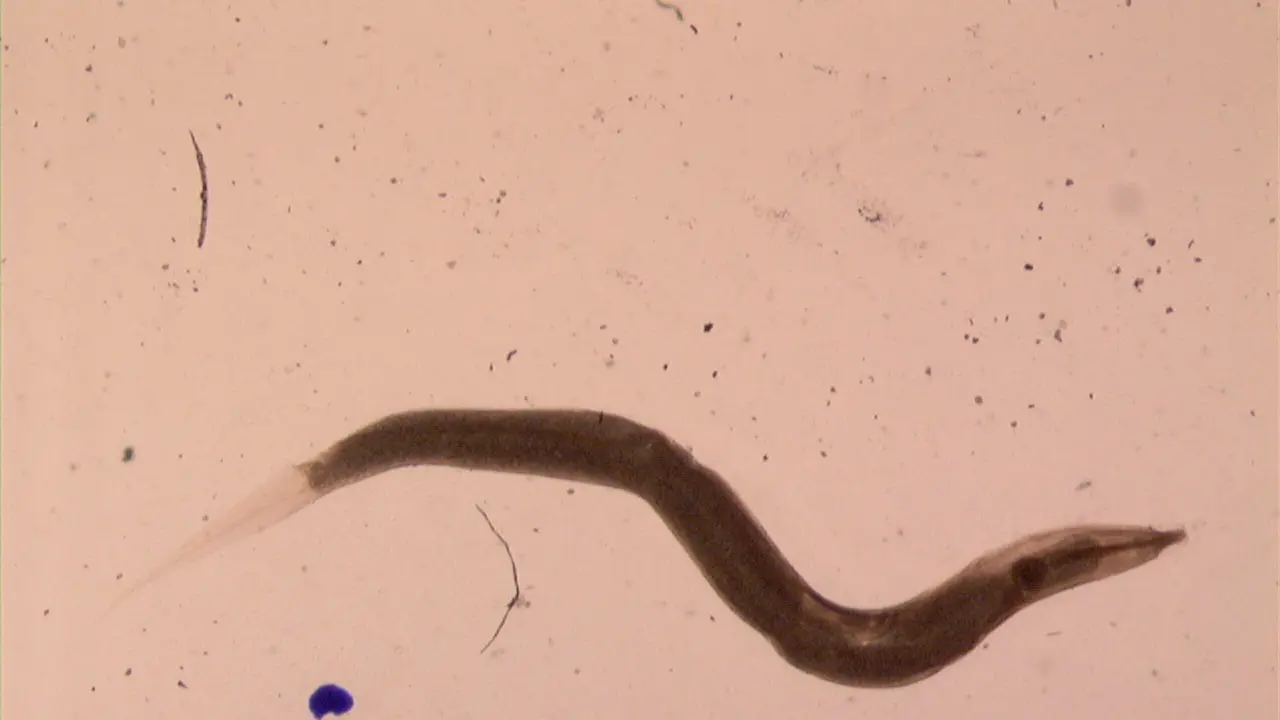 Kenali 4 Jenis Cacing yang Bikin Anak Cacingan - Health Liputan6.com