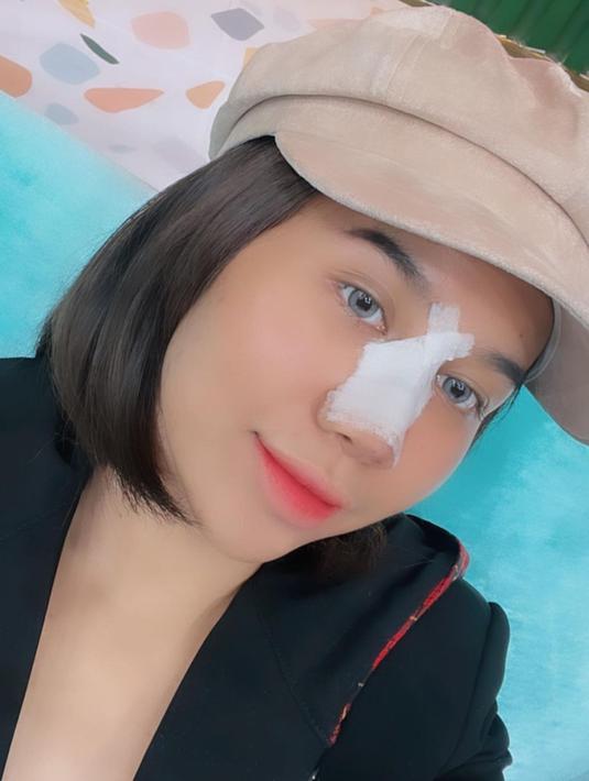 6 Potret Before-After Mayang Adik Vanessa Angel Operasi Hidung, Makin Cantik? - Photo Fimela.com