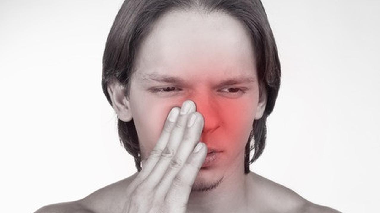 Ciri Ciri Sinus Hidung: Kenali Gejala dan Penanganannya